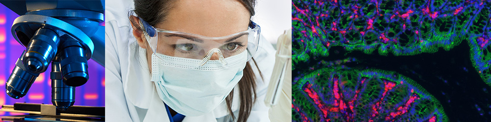 Program in Innate Immunity - Research